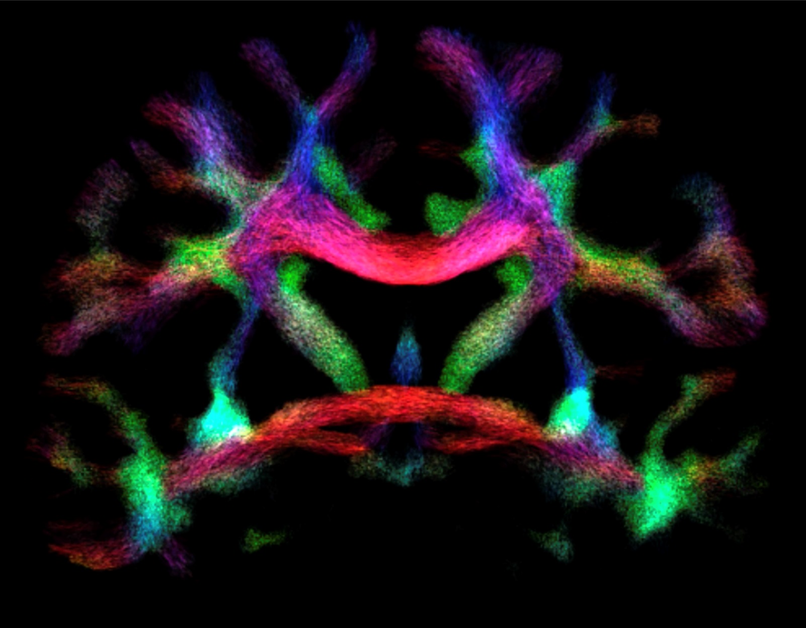 World first multiple sclerosis global image database launched - The ...