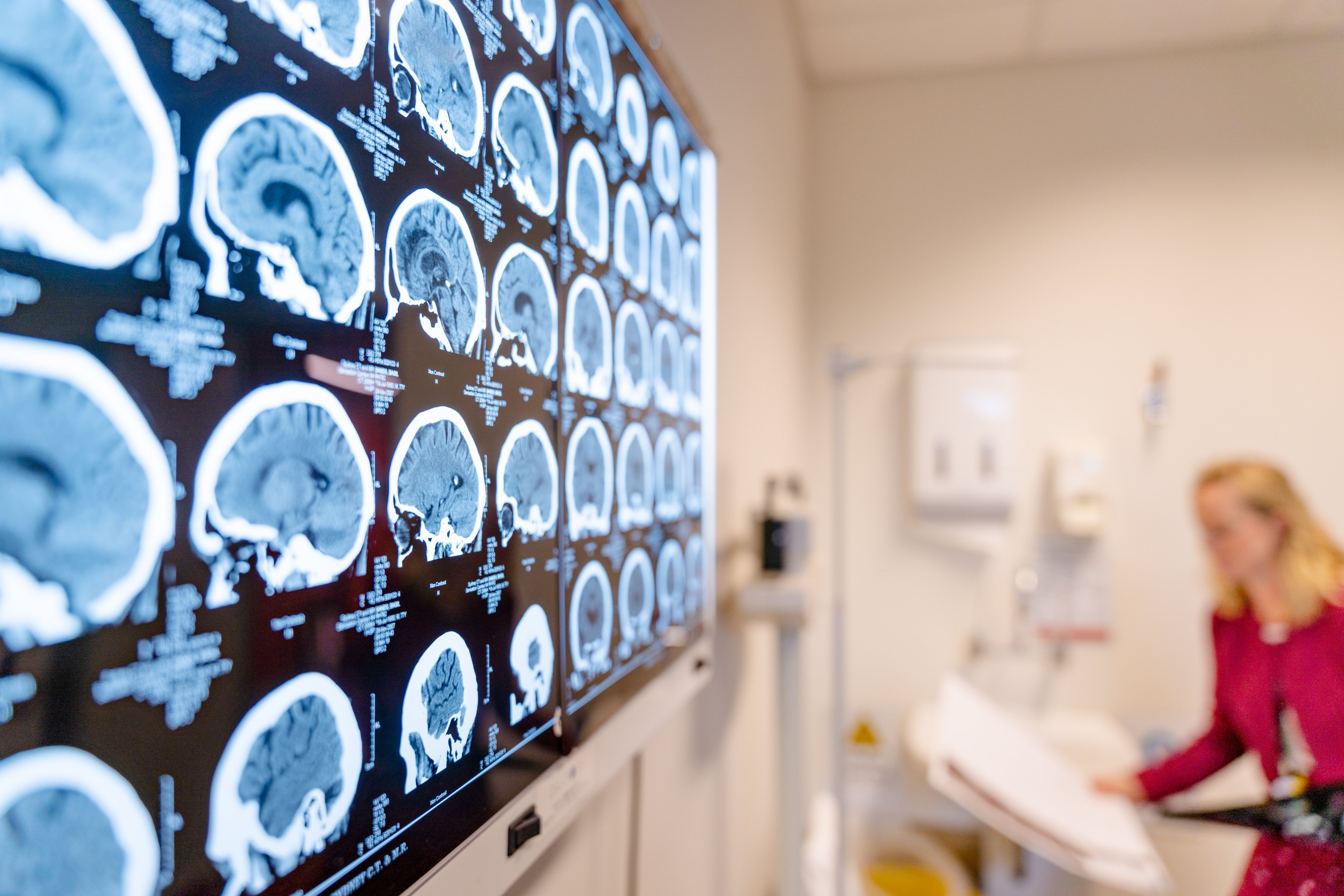 2021 Investigator Grants for Brain and Mind Sciences - Brain and Mind ...